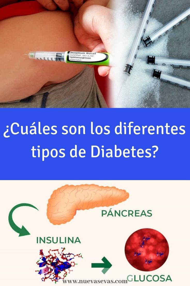 ¿Cuales son los diferentes tipos de Diabetes? Causas, Síntomas y ...