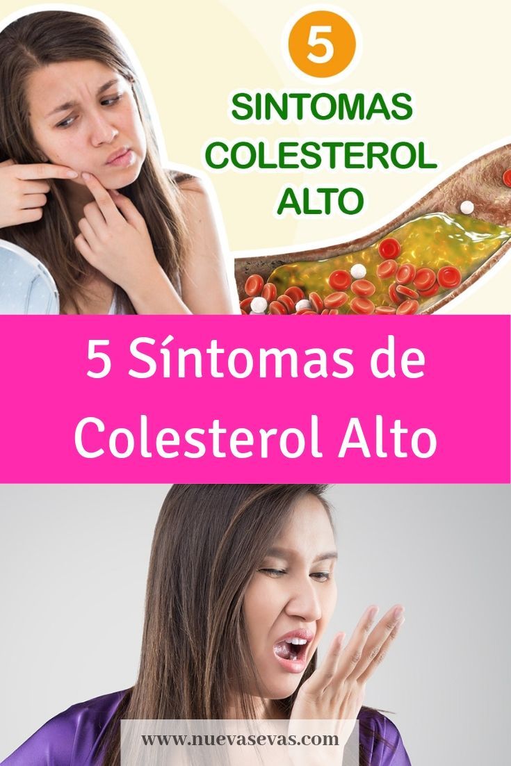 5 Síntomas de Colesterol Alto | Nuevas Evas